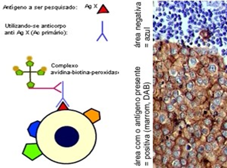 Imunohistoquímica: o que é - Blog