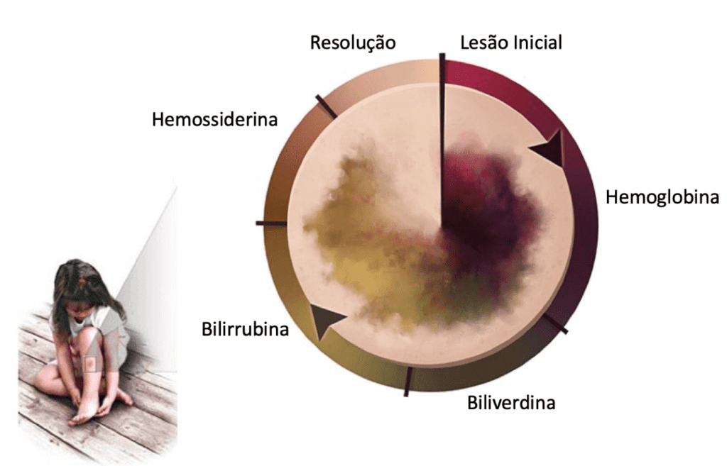 Hemodinâmica: Principais complicações - Blog